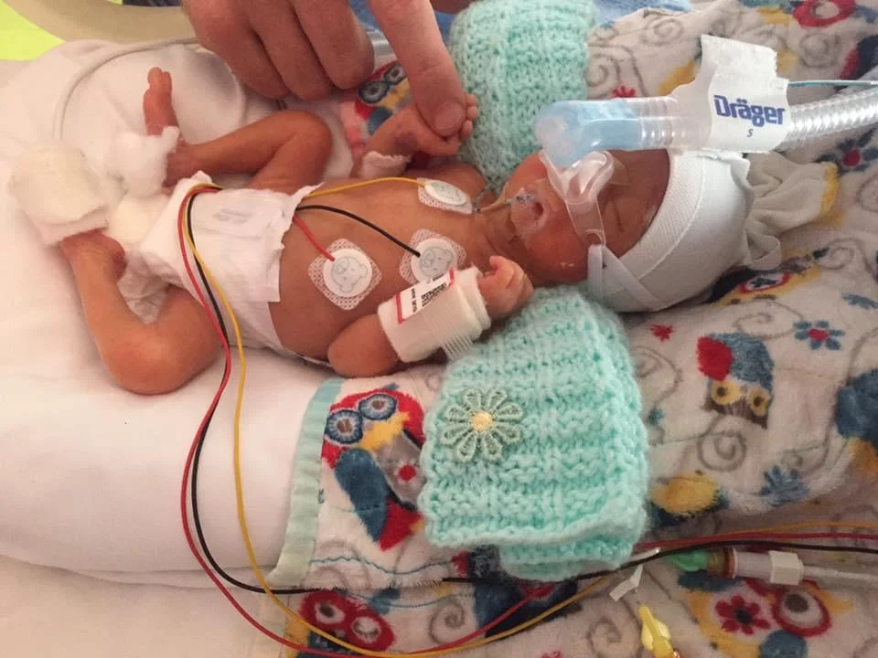 Jacques' Neonatal Story | Priaulx Premature Baby Foundation